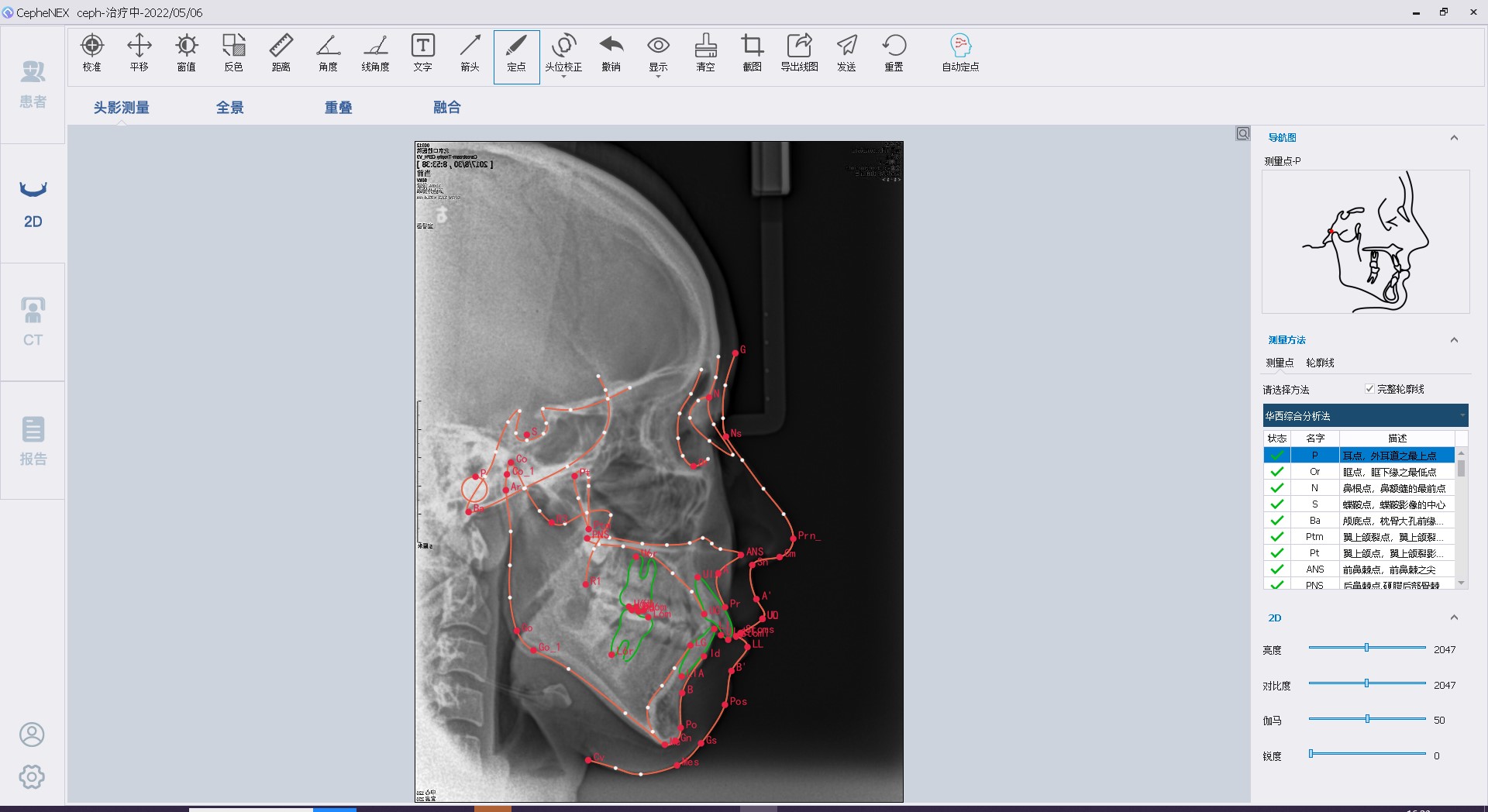 FusionOne客户端 | 朗视正畸