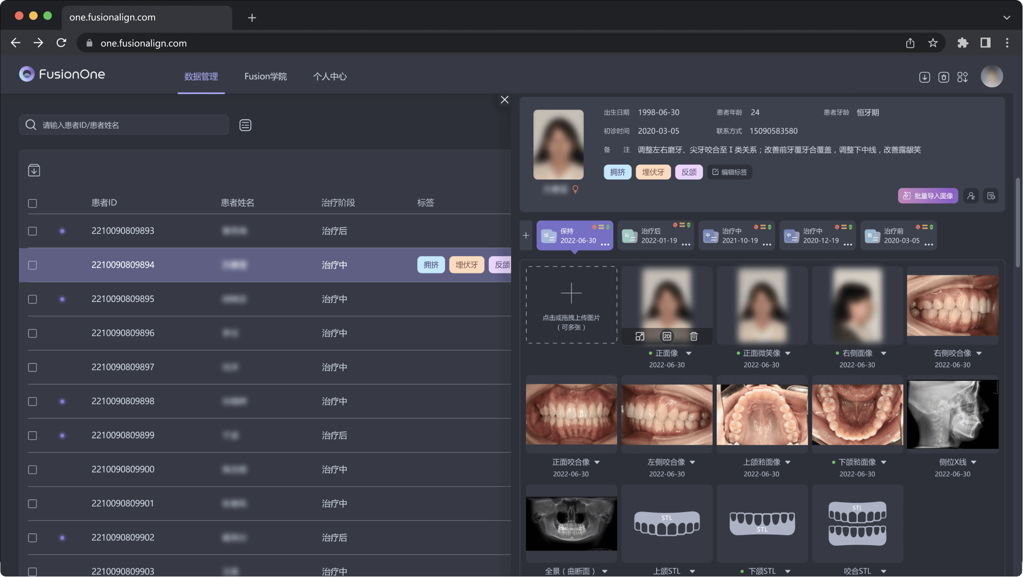 FusionOne网页端 | 朗视正畸