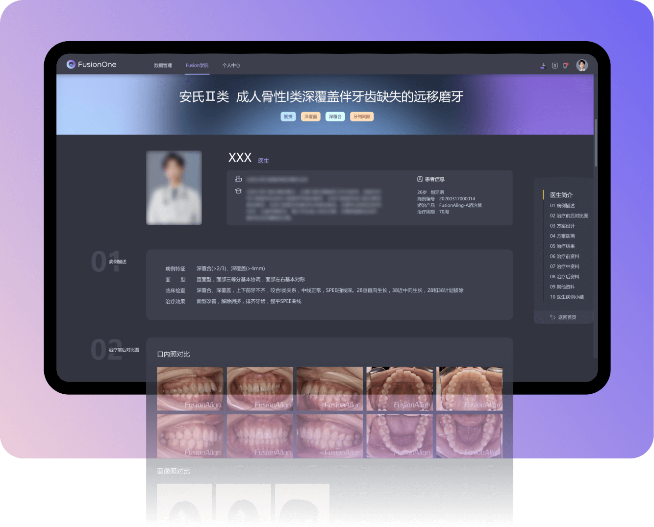 FusionOne网页端 | 朗视正畸