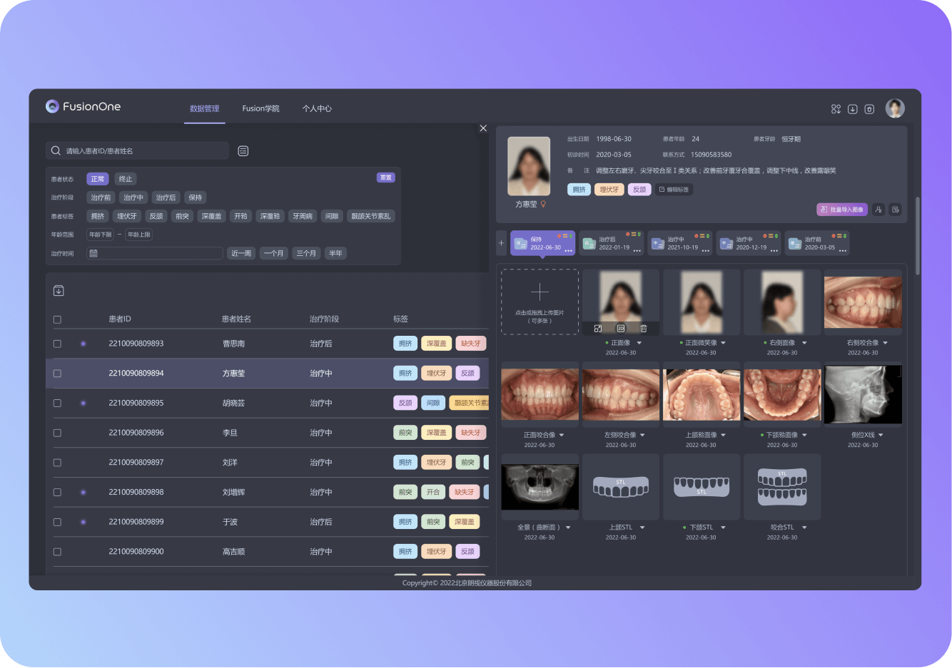 FusionOne网页端 | 朗视正畸