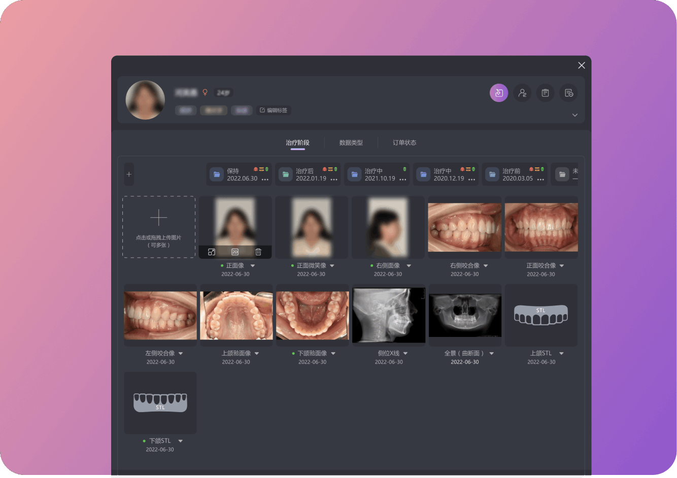 FusionOne网页端 | 朗视正畸