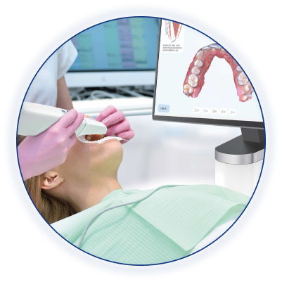 FusionScanner口腔数字印模仪 | 朗视正畸